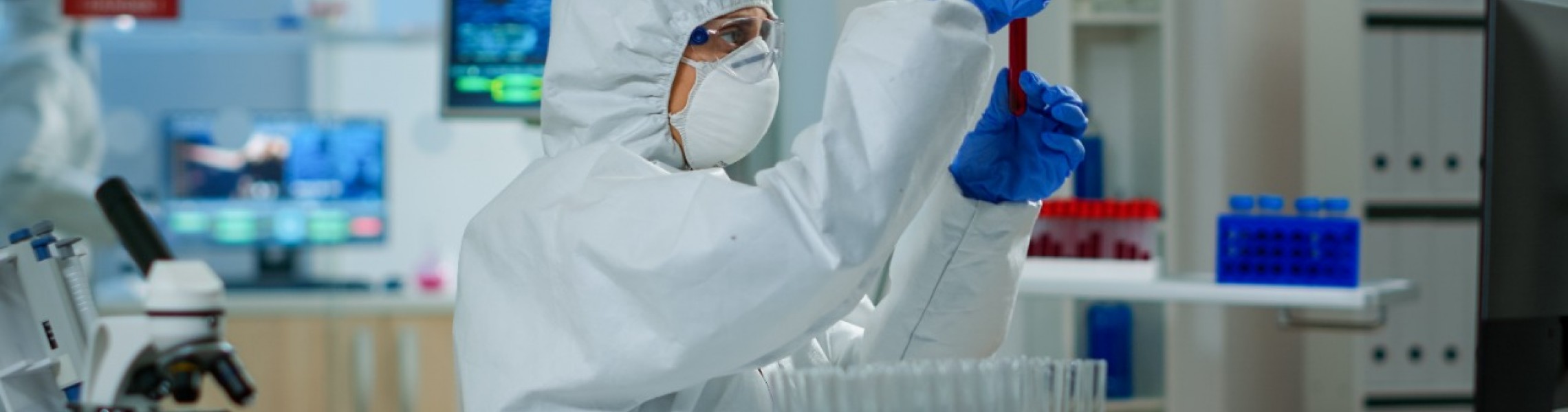 How To Handle Primary and Secondary Reference Standards?